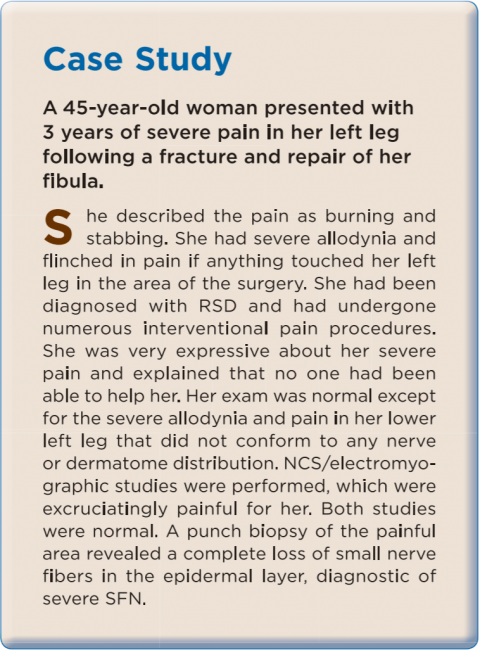 Diagnosis of Reflex Sympathetic Dystrophy / Complex Regional Pain ...